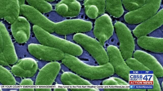 New case of flesh-eating bacteria confirmed in Florida | WJAX-TV